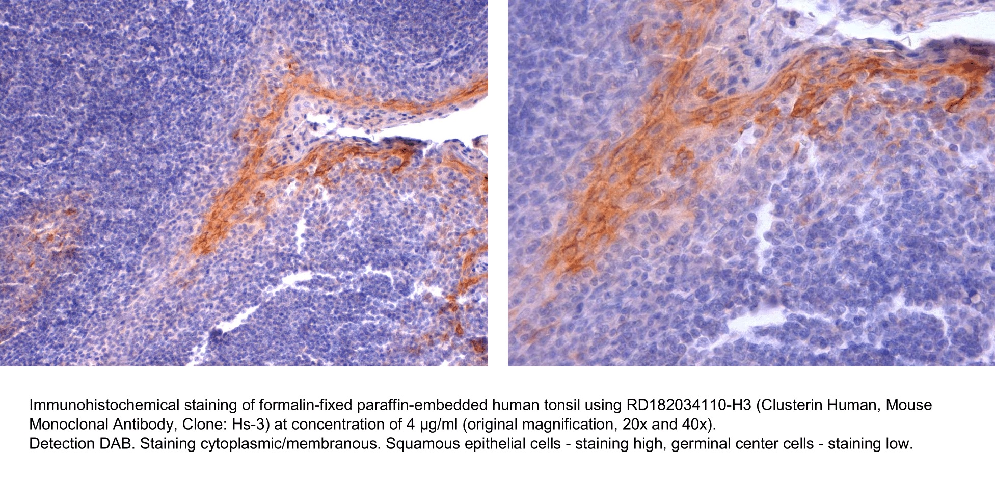 Clusterin Human, Mouse Monoclonal Antibody, Clone: Hs-3 | BioVendor R&D