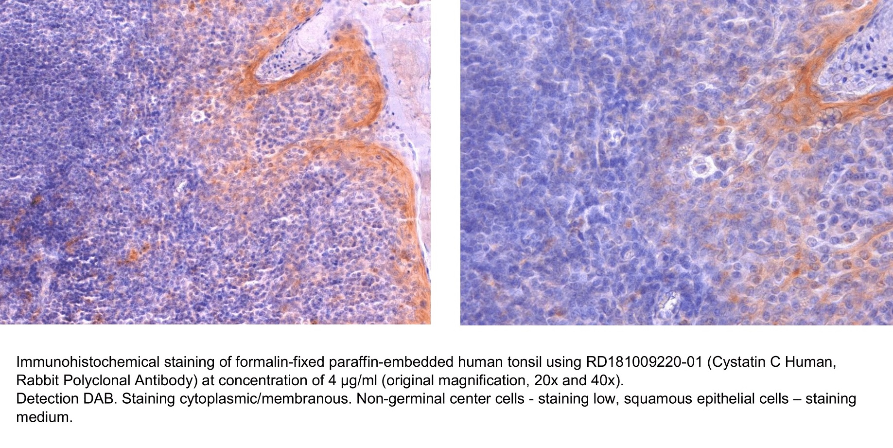 Cystatin C Human, Rabbit Polyclonal Antibody | BioVendor R&D