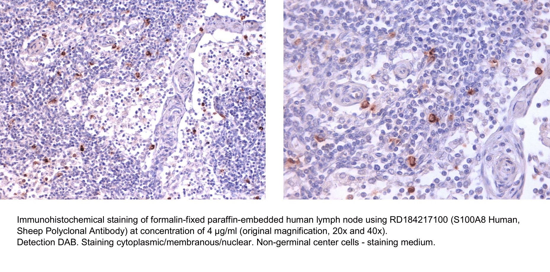 S100A8 Human, Sheep Polyclonal Antibody | BioVendor R&D