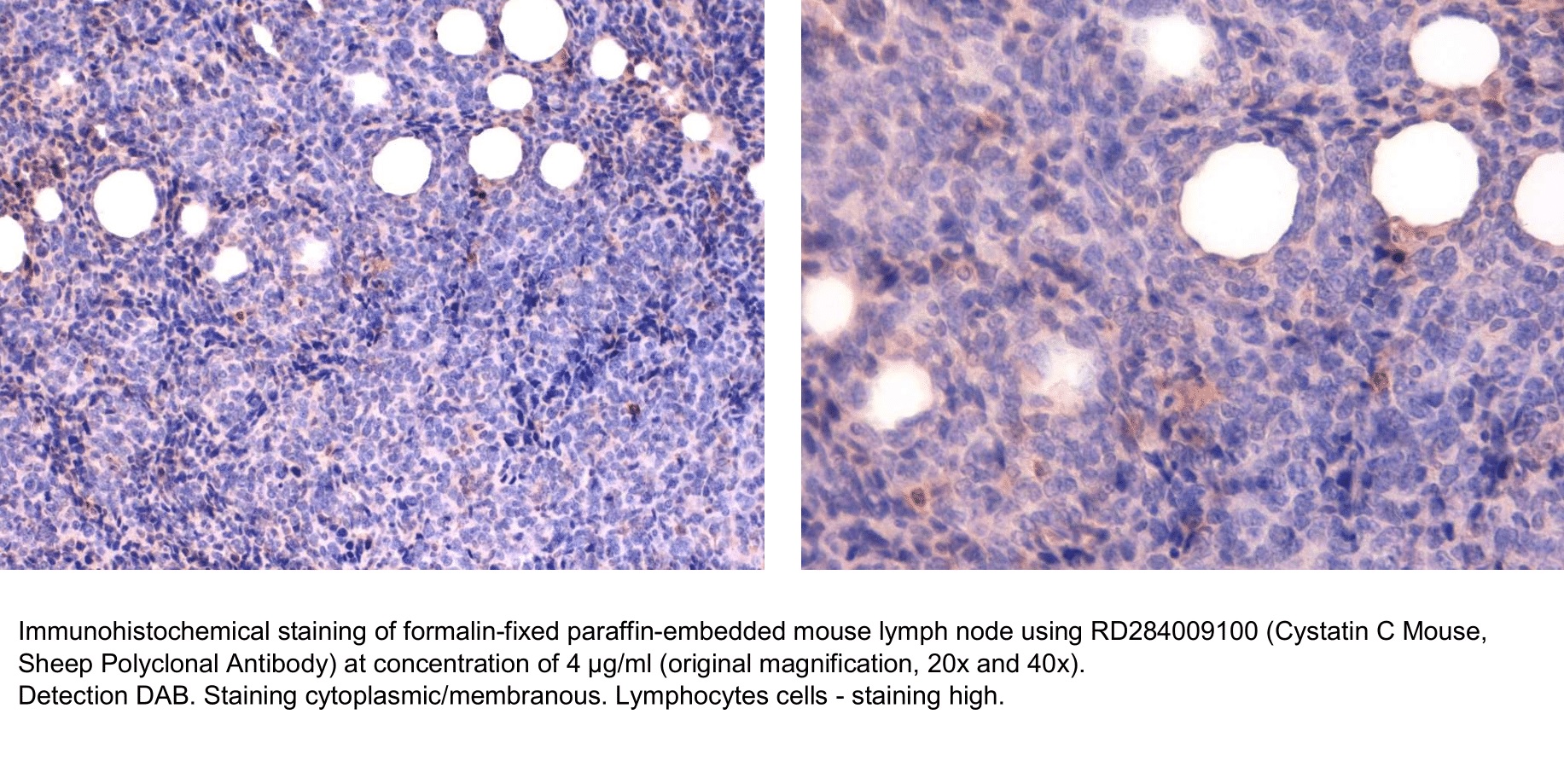 Cystatin C Mouse, Sheep Polyclonal Antibody | BioVendor R&D