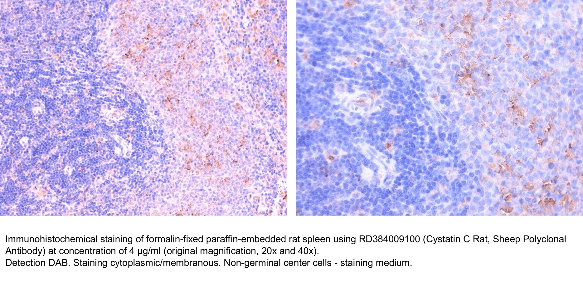 Cystatin C Rat, Sheep Polyclonal Antibody | BioVendor R&D
