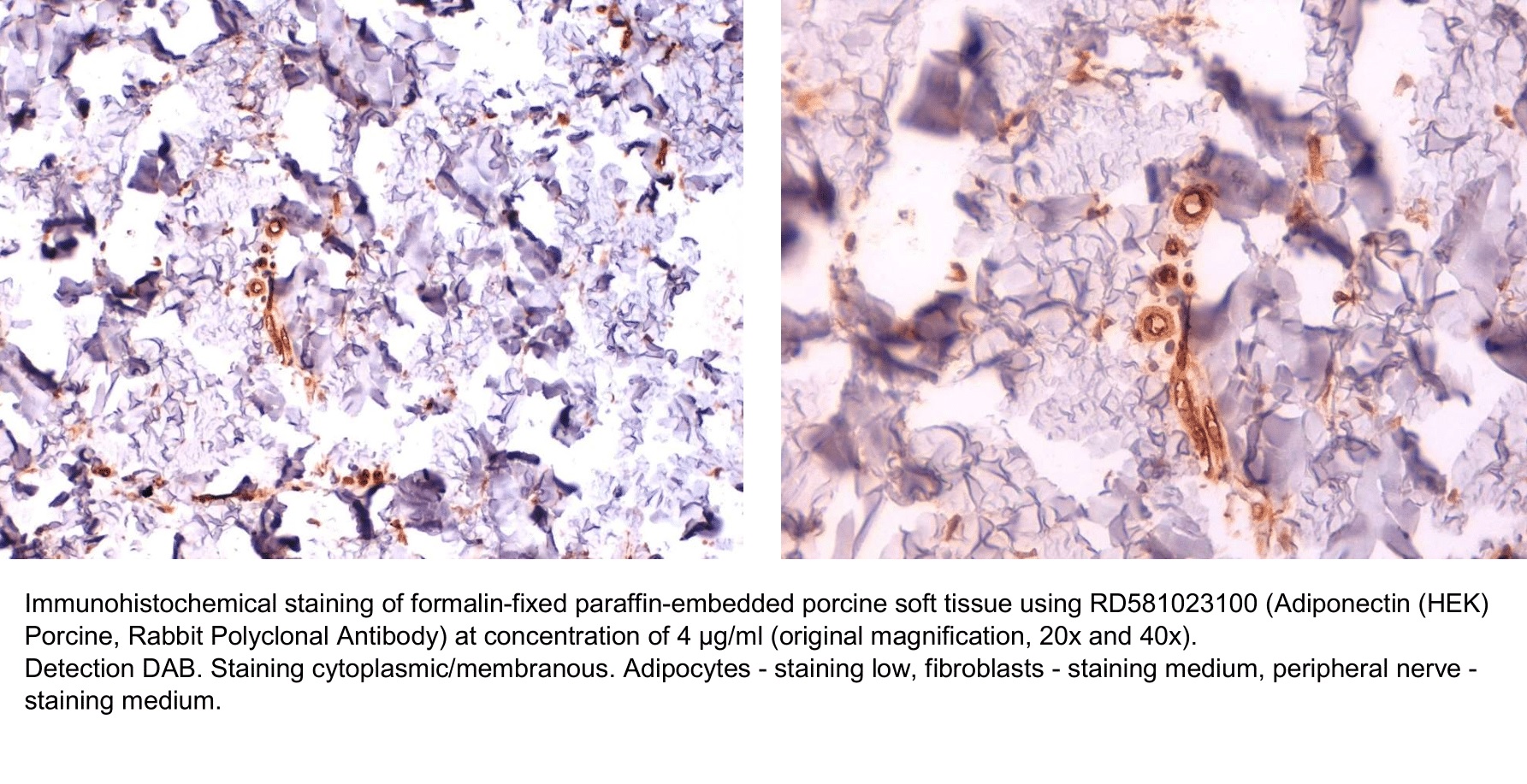 Adiponectin (HEK) Porcine, Rabbit Polyclonal Antibody | BioVendor R&D