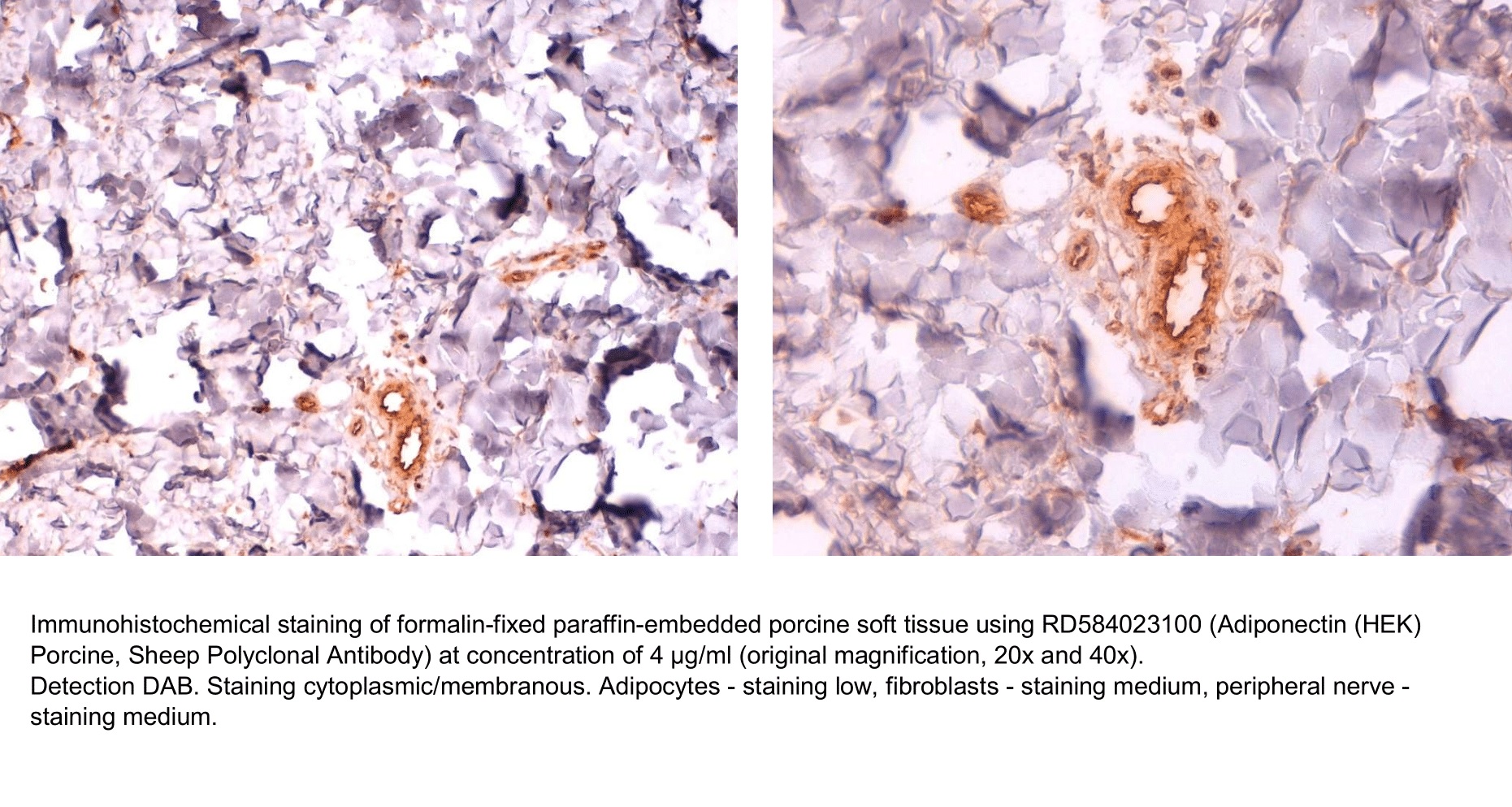Adiponectin (HEK) Porcine, Sheep Polyclonal Antibody | BioVendor R&D