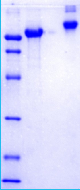 ENPP1 Protein Mouse HEK293 | BioVendor R&D
