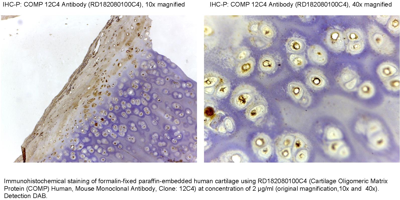 Cartilage Oligomeric Matrix Protein Human, Mouse Monoclonal Antibody ...